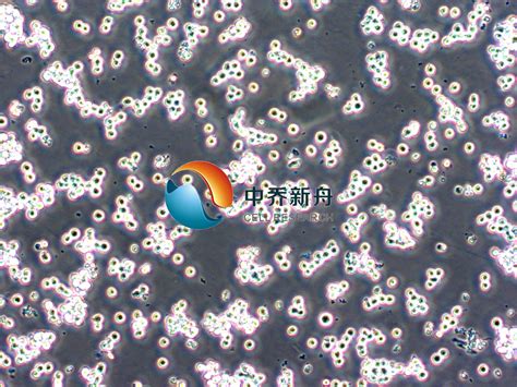 OCI LY10细胞 细胞株 弥漫大B淋巴瘤细胞 中乔新舟生物科技有限公司