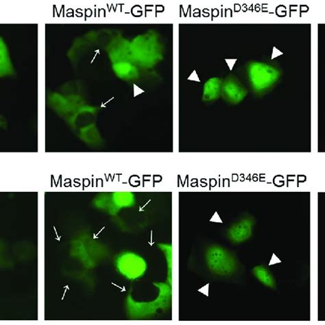 A Confocal Immunofluorescence Imaging Of Maspin Green And Nuclear