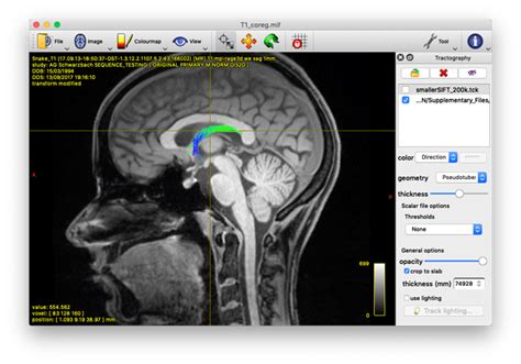 Mrtrix Tutorial Available On Osf Page 2 Blog Mrtrix3 Community