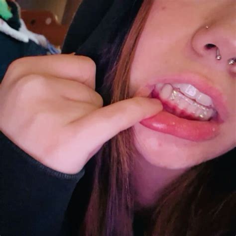 Pin On Tooth Gems In 2024 Dying My Hair Tooth Gem Hair Again