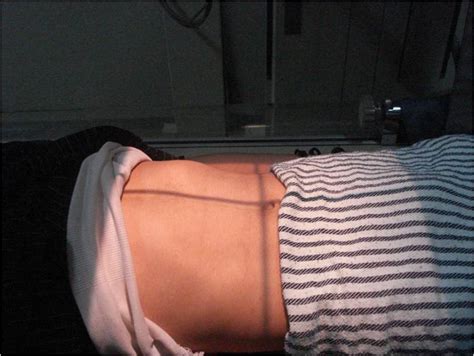 Proyeksi Pemeriksaan Abdomen 3 Posisi Aditya Radiografer