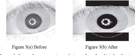 figure 3 from development of iris based age and gender detection system