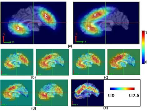 Pbm On Simulated Data A Simulated Patterns Introduced In The