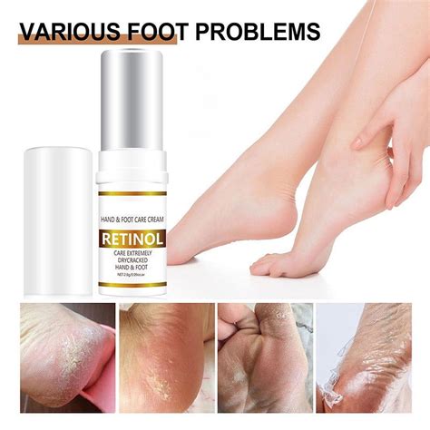 Ewaswon Foot Cream For Cracked Heels Dry Skin Retinol Heel Dry And Cracked Foot Cream