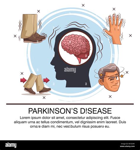 Parkinsons Disease Infographic Stock Vector Image And Art Alamy