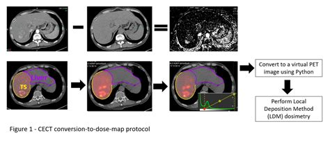 Mapping Contrast Enhanced Ct Images To Liver Radioembolization Doses A