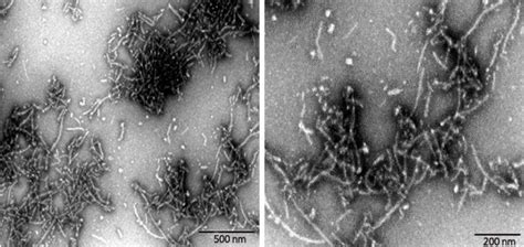 Modelling Of Neurodegenerative Diseases
