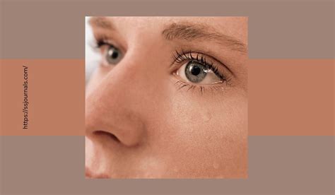Flashing Lights Eyes After Cataract Surgery Shelly Lighting