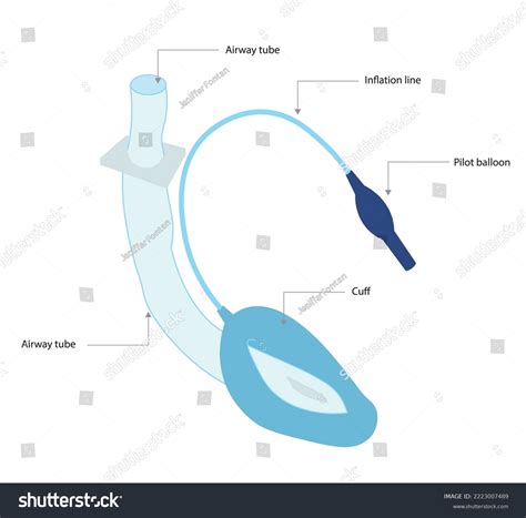Laryngeal Mask Airway Lma Structures Illustration Stock Vector Royalty