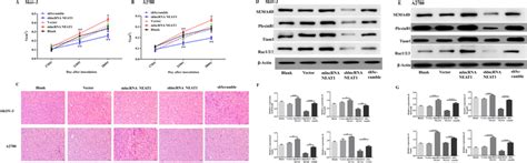 Neat1 Promoted Angiogenesis In Xenografted Human Ovarian Cancer Tissues