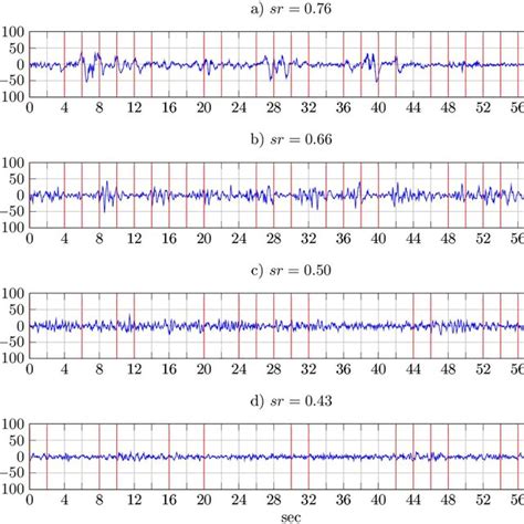 segmentation results segment rates sr for different eeg patterns a