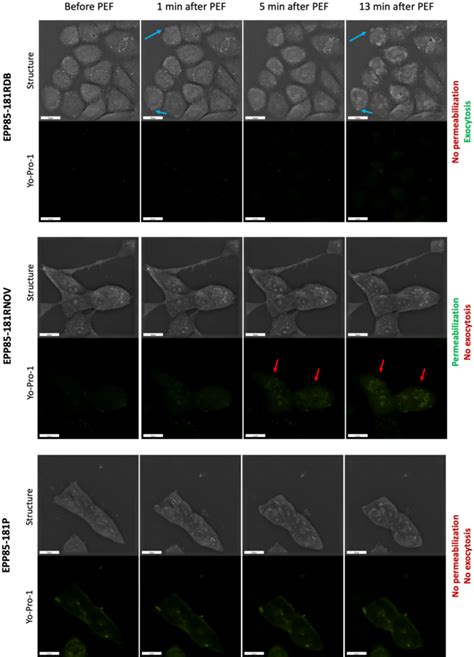 纳秒脉冲电场抑制胰腺癌生长并降低多重耐药效应scientific Reports X Mol
