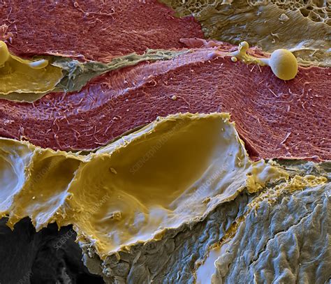 Atrophied Muscle Sem Stock Image C0580900 Science Photo Library