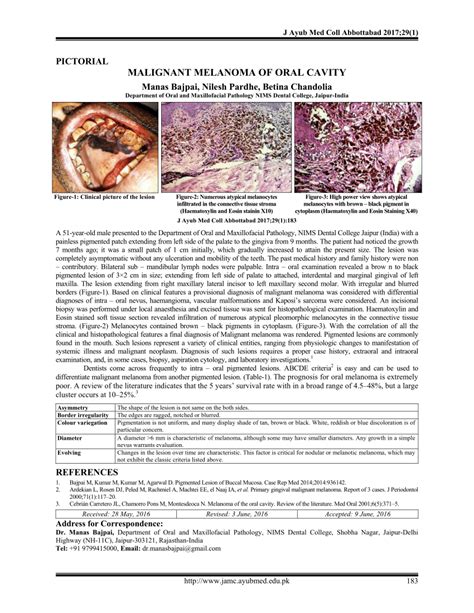 Pdf Malignant Melanoma Of Oral Cavity