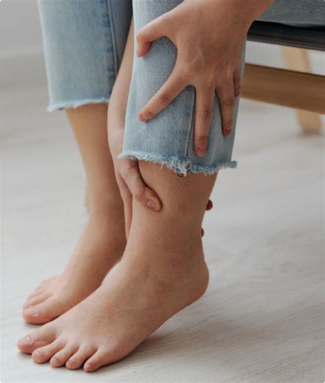 Leg Swelling