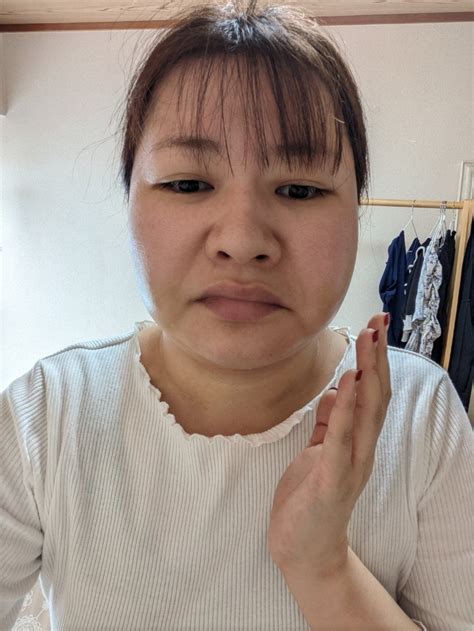 今日は脂肪吸引2日目ー！おはよう！ 健康美人ともみオフィシャルブログ「健康美人になるまでの記録」powered By Ameba