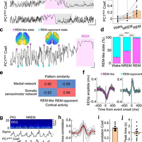 Mesoscale Ca²⁺ Imaging Of The Dorsal Cortex During The Sleep Wake