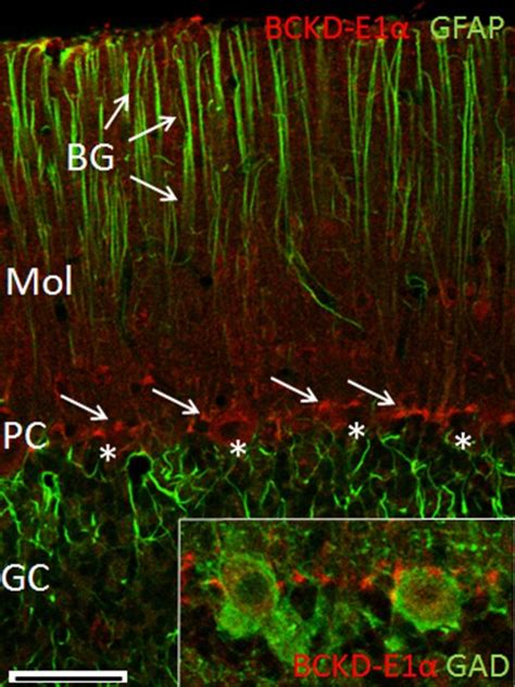 Immunolocalization Of Bckdc E1α In The Cerebellar Cortex Download