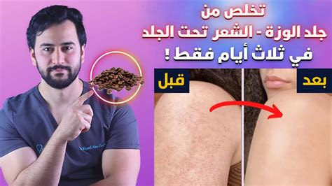 اسرع طريقة لتحصل على جلد أملس ناعم كالحرير تخلص من جلد الوزة نهائيا