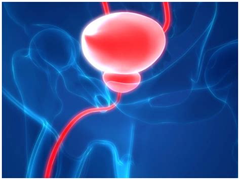 Prostate Laser Surgery Laser Prostatectomy All Your Questions Answered By Dr Rajan Bansal