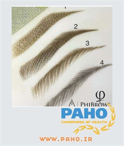 فیبروز ابرو چیست؟ راه حلی دائمی برای داشتن ابروهایی زیبا و طبیعی