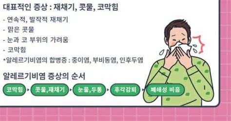 봄철 알레르기성 비염 치료 ‘항히스타민제 안전한 사용법은