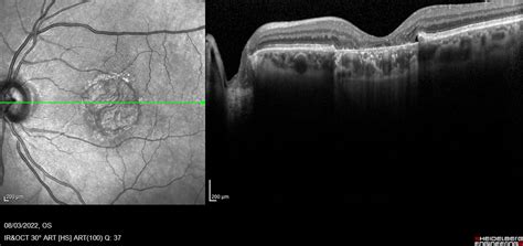 Optician Online CPD Archive