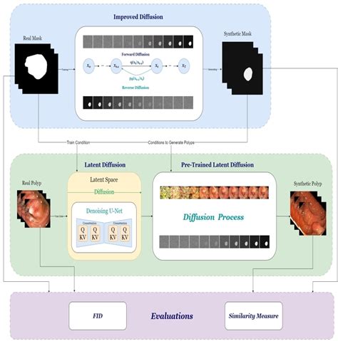 Mask Conditioned Latent Diffusion For Generating Gastrointestinal Polyp Images
