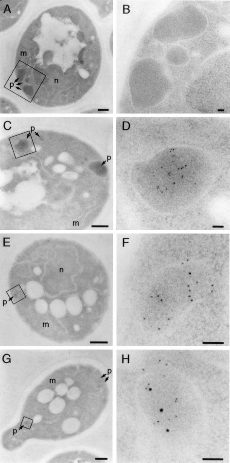 Subcellular Localization Of Gfp Skl In Yeast Pex5 Mutants Expressing A