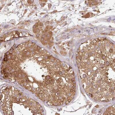 GSPT1 Antibody BSA Free NBP2 47442 Novus Biologicals