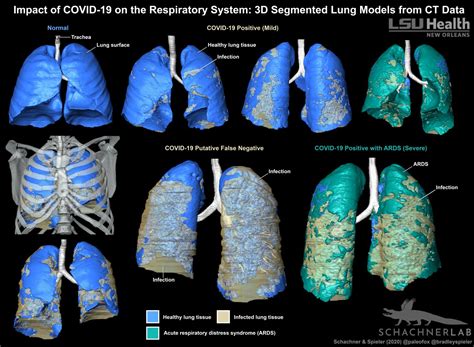 3d Segmented Lung Models Of Co Image Eurekalert Science News Releases