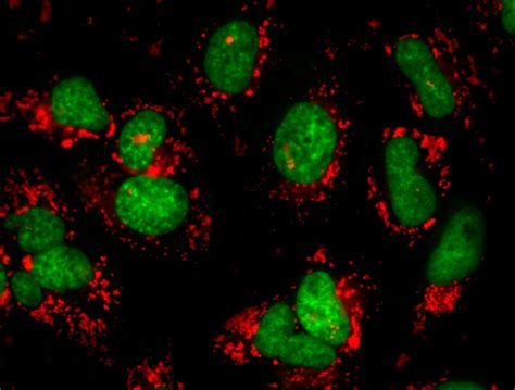 核绿 Lcs1 活细胞染料西安百萤生物科技有限公司