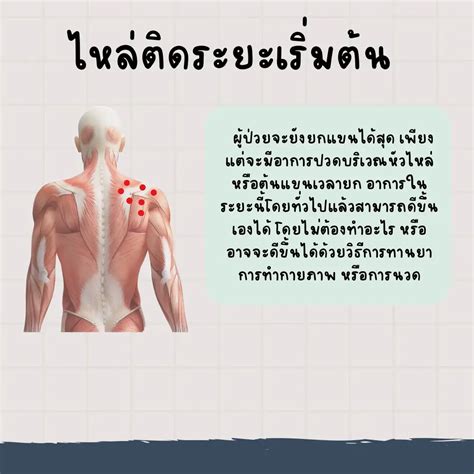 เช็คระยะอาการหัวไหล่ติด 💡 แกลเลอรีที่โพสต์โดย Choojai Ladprao Lemon8