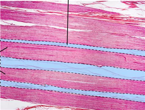 Nerve Longitudinal Section Flashcards Quizlet