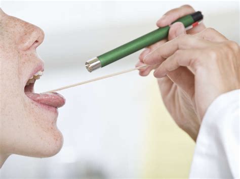 Strep Throat Symptoms Of Strep Throat