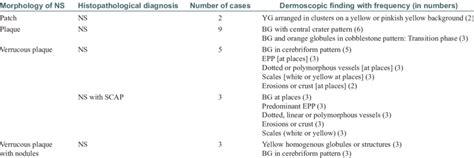 Dermoscopic Features Of Nevus Sebaceus According To Evolutionary Stage