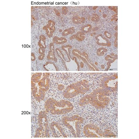 Solarbio K111452p Anti Mmp3 Polyclonal Antibody 试剂仪器耗材