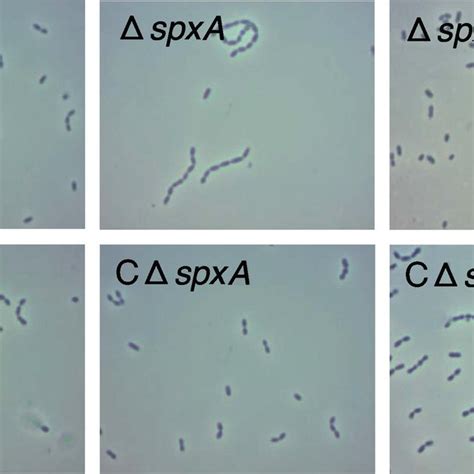 Phase Contrast Microphotographs Of S Mutans Ua159 Spxa Spxb Spxab