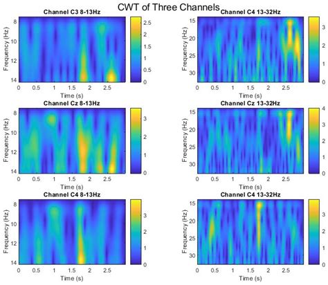 Enhancing Motor Imagery Classification In Braincomputer Interfaces Using Deep Learning And