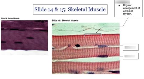 Skeletal Muscle Diagram Quizlet