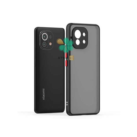 قاب گوشی شیائومی Mi 11 Lite پشت مات محافظ لنزدار استایل آپ