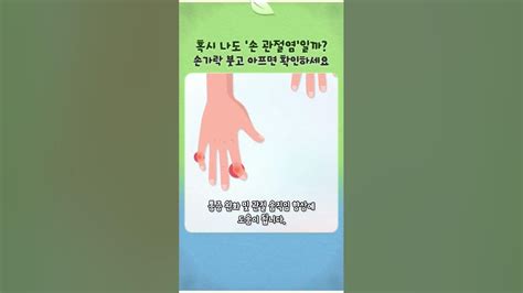 혹시 나도 ‘손 관절염일까 손가락 붓고 아프면 확인하세요 Youtube