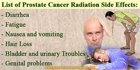 Prostate Cancer Radiation Side Effects Prostate