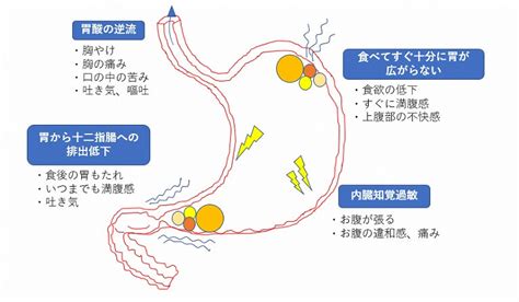 お腹 すき すぎ て お腹 痛い