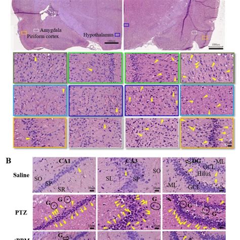 Protective Effects Of Tpbm Against Se Induced “dark Neurons” In The