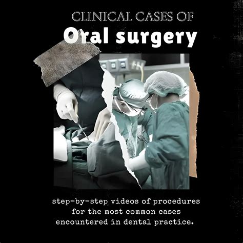 Clinical Cases Of Oral Surgery Dental Knowledge