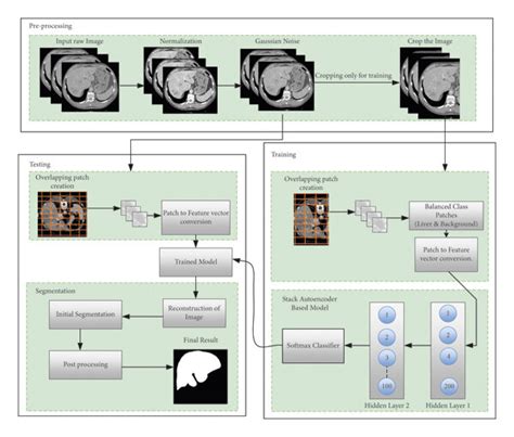 The Workflow Of The Proposed Liver Segmentation Model Download