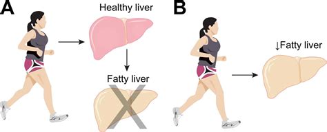 How To Make Your Liver Less Fatty
