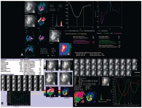 Quantitative Analysis Of Left Ventricular Function As A Tool In Clinical Research Theoretical