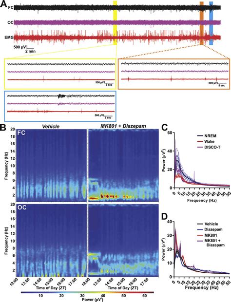 Nmda Antagonism And Gaba A Activation Recapitulates Aspects Of The Download Scientific Diagram